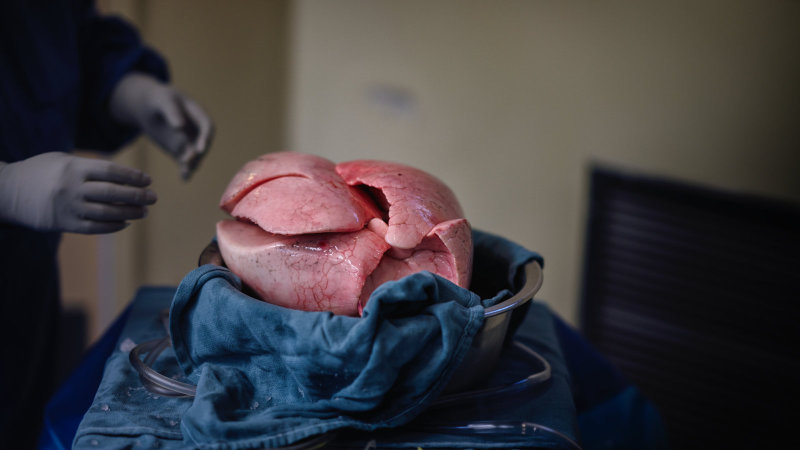 Unither Bioelectronics - A Breath in the Sky